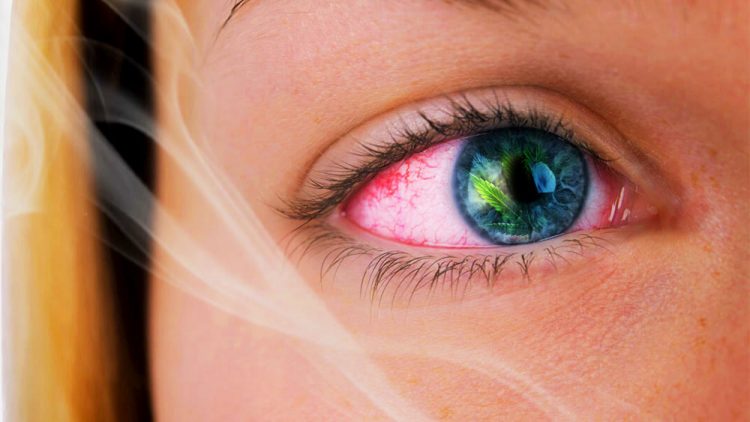Do Edibles Make Your Eyes Red? | Everything You Should Know About